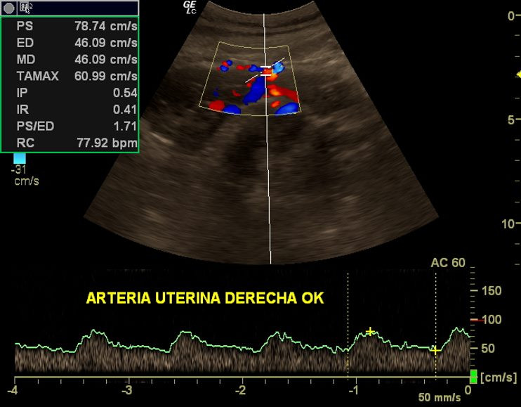 Galeria Imágenes de ultrasonografías en 3D, 2D y pruebas prenatales ...